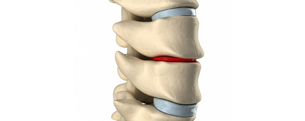 De mens: een rugkwaal op twee benen | KIJK Magazine