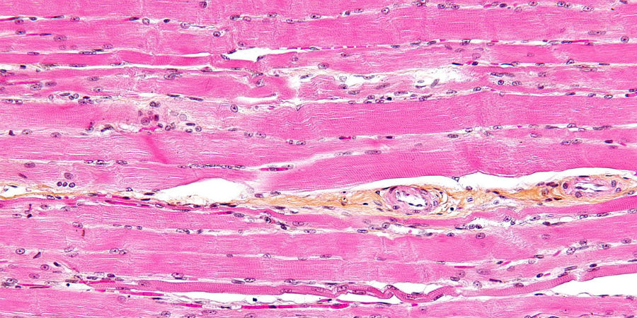 'Levend spierweefsel' helpt robot bewegen | KIJK Magazine